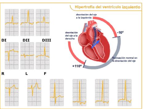Ppt Electrocardiograma Normal Powerpoint Presentation Free Download
