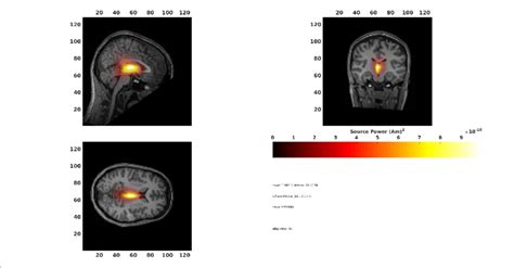 Beamformer Source Reconstruction It Can Be Seen That The Reconstructed Download Scientific
