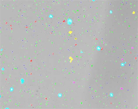 Yeast Analyzer Particletech