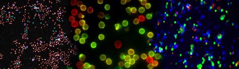 Quantitative Analysis Labeled Cells Imaging Cytometry