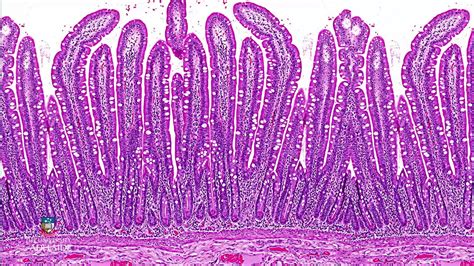 From Biopsy To Microscopy Tissue Processing For Light Microscopy