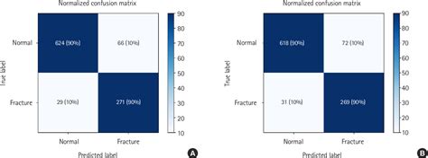 Table 2 From Application Of Convolutional Neural Networks For Distal Radio Ulnar Fracture