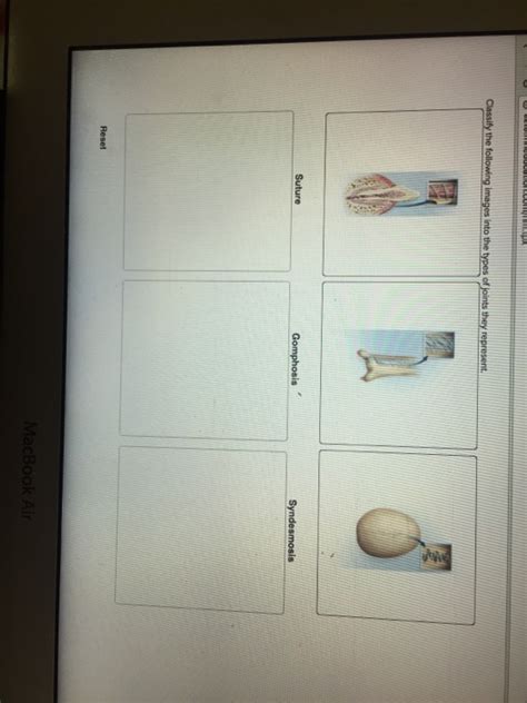 solved classify the following images into the types of