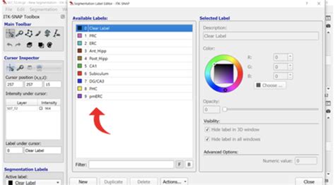 2 Using Itk Snap For Segmentation — Weis Menu For Neuroimage 001