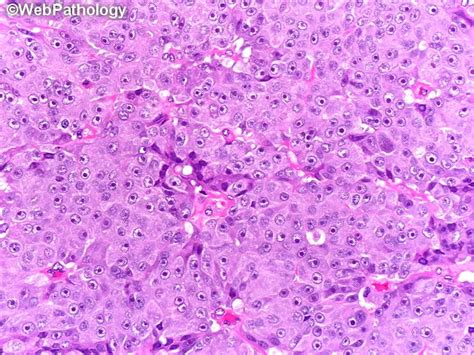 Acinar Cell Ca Microscopic