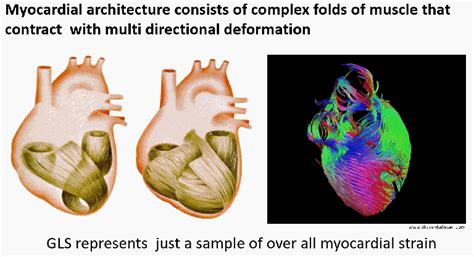 Limitations Of Gls Echo Drsvenkatesan Md