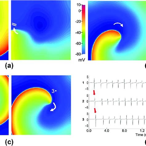 computational simulations in the 2d atrial model snapshots of membrane