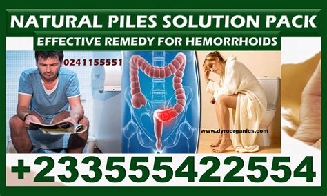 Natural Supplements For Hemorrhoids In Ghana Accra Kumasi Tamale
