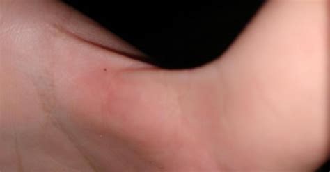 New Mole Doesnt Act Nor Feel Like Splinter Album On Imgur