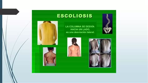 Higiene Postural Pptx