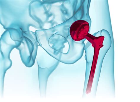 Tebit The Medical Group