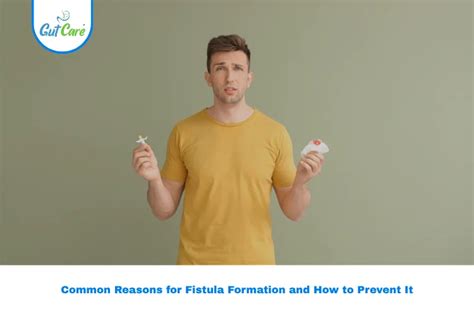 Fistula Treatment Without Surgery Fistula Plugs Explained