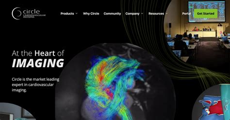 What Is 4d Flow Mri Circle Cardiovascular Imaging What Is 4d Flow Mri Circle Cardiovascular Imaging