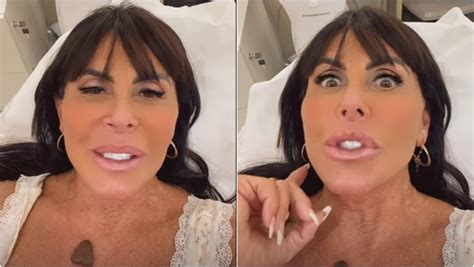 Gretchen Se Revolta Ao Ser Chamada De Aberração Após Harmonização Facial