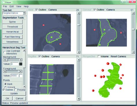 applying hierarchical segmentation by placing interior points green