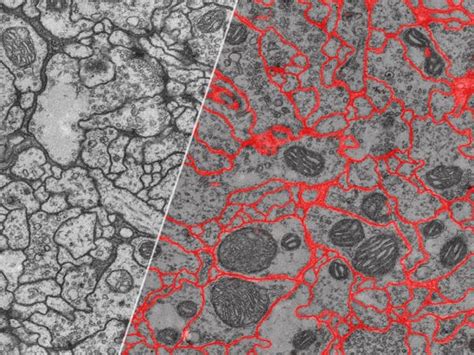 Matlab Code For Effective Segmentation Of Image Using Otsu Thresholding