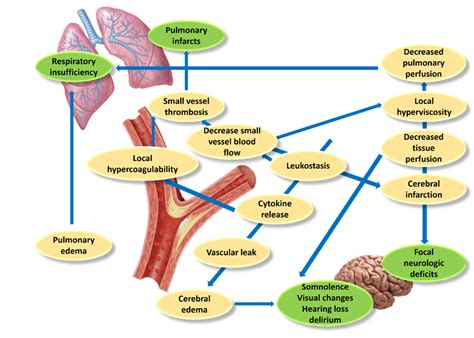 Hyperleukocytosis Cancer Networks