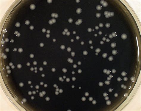 Utiliza Agar Legionella Gvpc Composición Y Aplicaciones