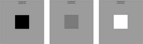 Examples Of Images According To The Tg18 Ln Pattern Tg18 Ln12 01 Download Scientific Diagram