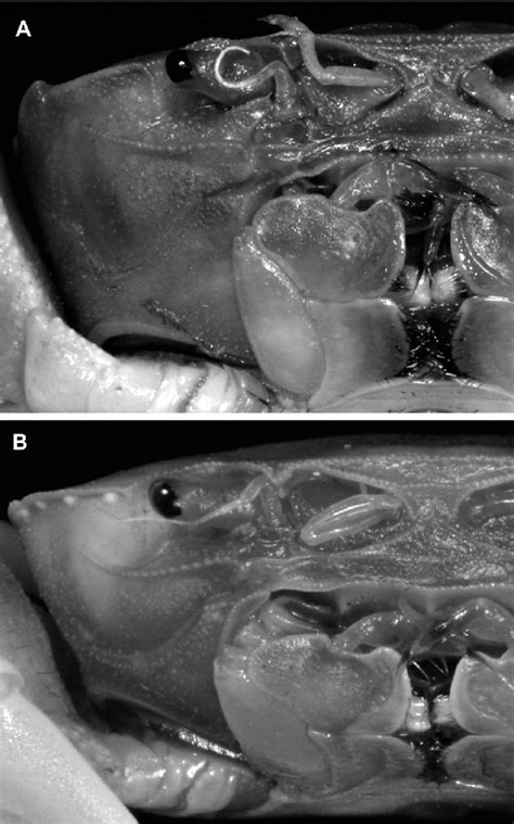 Frontal View Showing Epistome Frontal And Anterolateral Margins And