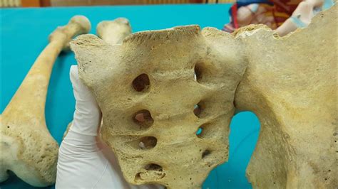 Juncturae Cinguli Pelvici Artsacroiliacasakroiliak Eklem Anatomisi 1