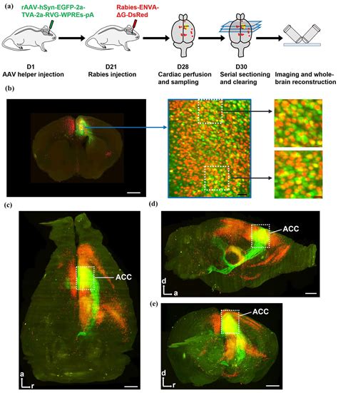 Whole Brain Mapping Of Afferents To The Anterior Cingulate Cortex In