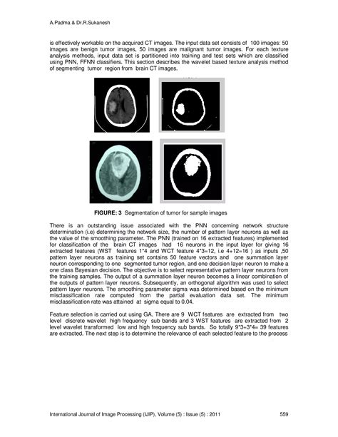 A Wavelet Based Automatic Segmentation Of Brain Tumor In Ct Images Using Optimal Statistical