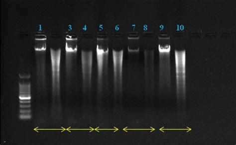 Agarose Gel Of Undigested And Digested Dna Extracted From Lesser Yam Download Scientific Agarose Gel Of Undigested And Digested Dna Extracted From Lesser Yam Download Scientific