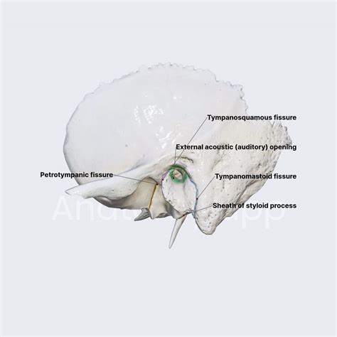 Tympanic Part Of Temporal Bone Anatomyapp