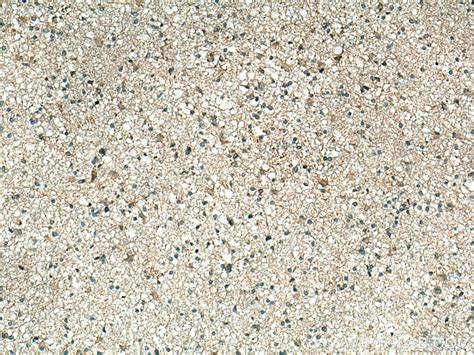 Ppp5c Antibody 11715 1 Ap Proteintech