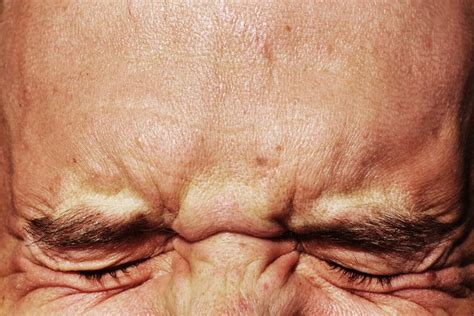 Pin On Herniated C5 C6 C7