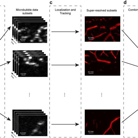 Pdf Short Acquisition Time Super Resolution Ultrasound Microvessel Imaging Via Microbubble