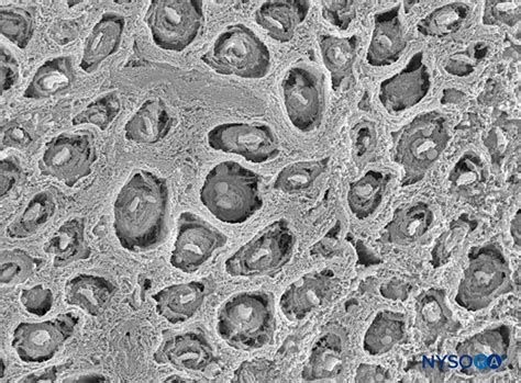 Talkendoneurium Wikipedia