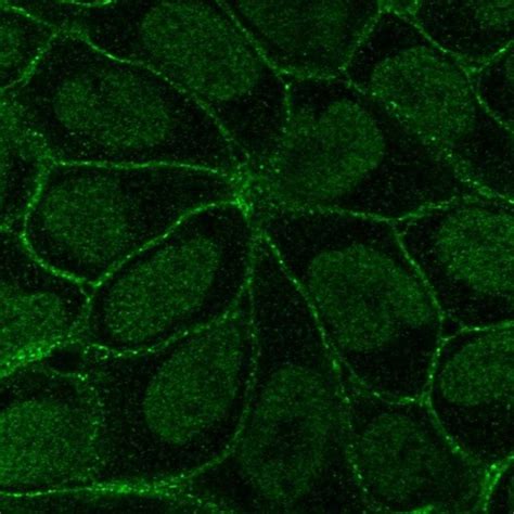 Rabbit Polyclonal Anti Itgb6 Antibody Buy For Research Highly