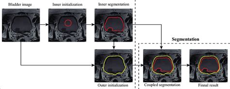The Workflow Of The Proposed Cdls Method For Bladder Wall Segmentation Download Scientific