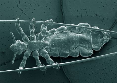 Head Lice Evolution Mirrors Human Migration And Colonization In The