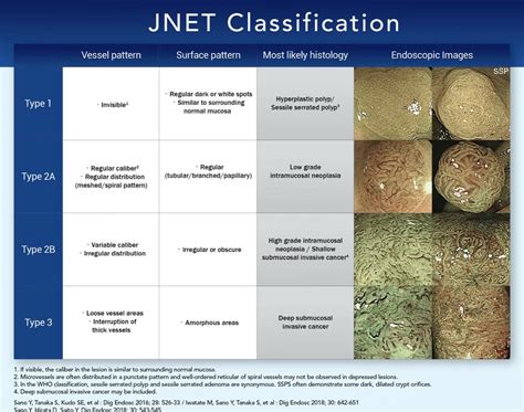 Jnet Classification Klaus Mönkemüller