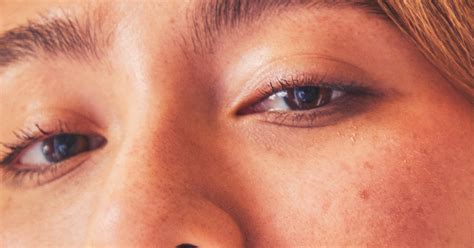 What Is Hypopigmentation A Skin Care Expert Explains POPSUGAR Beauty