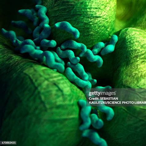 Campylobacter Poisoning Photos And Premium High Res Pictures Getty Images