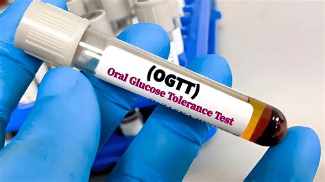 Oral Glucose Tolerance Test How Does This 3 Step Test Work To Detect Diabetes Early Onlymyhealth