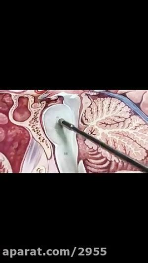 آناتومی مغز انسان