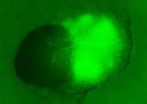 Scientists Create Human Mini Brain With Safety Systems