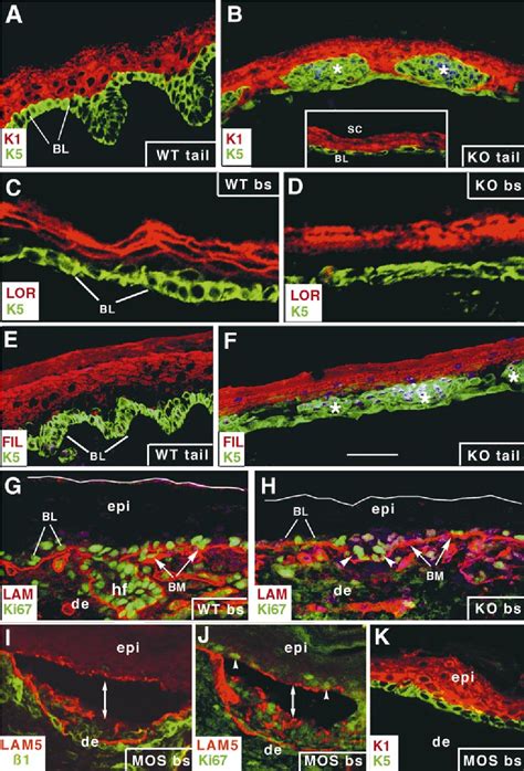 Figure 3 From Conditional Ablation Of Beta1 Integrin In Skin Severe Defects In Epidermal