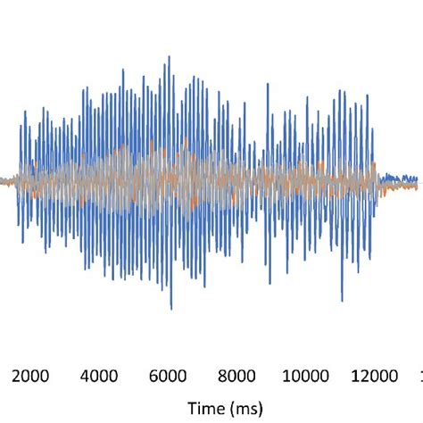 Waveform Of The Acceleration Component Of Micro Vibration Therapy