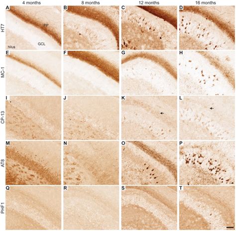 A D Htau Was Detected In Pp Terminals In The Outer Molecular Layer Of Download Scientific