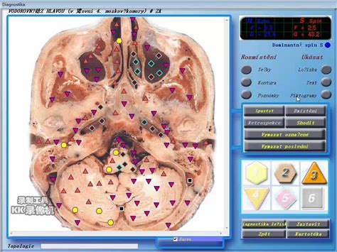 3d Nls Scan And Why 3d Nls Scan Maikong 3d Nls Health Analyzer 3d