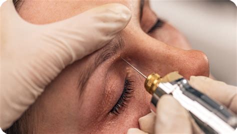 Fibroblast Skin Treatment Ageless Health Group