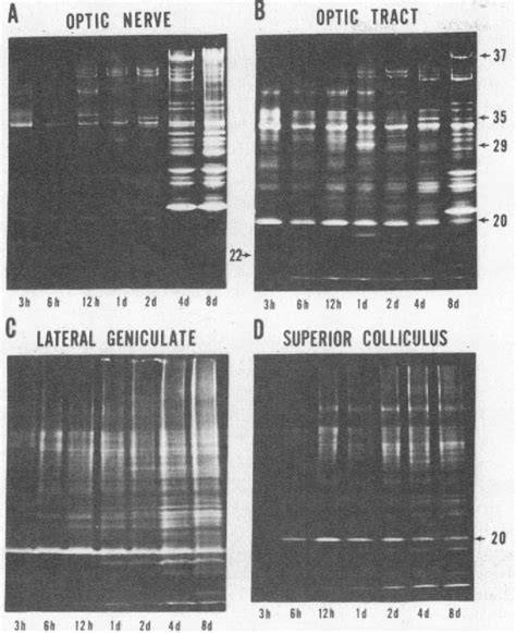 Figure 2 From The Polypeptide Composition Of Intra Axonally Transported