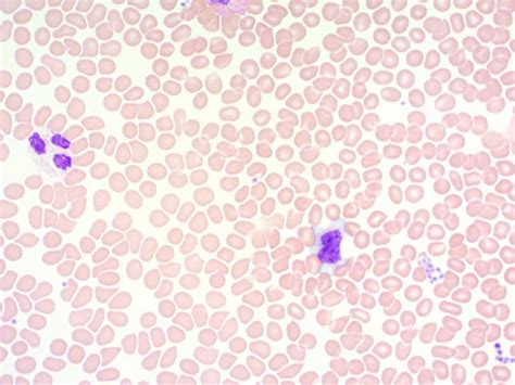 Wright Giemsa Stain Kit