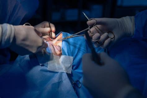 Premium Photo Blepharoplasty Plastic Surgery To Correct Eye